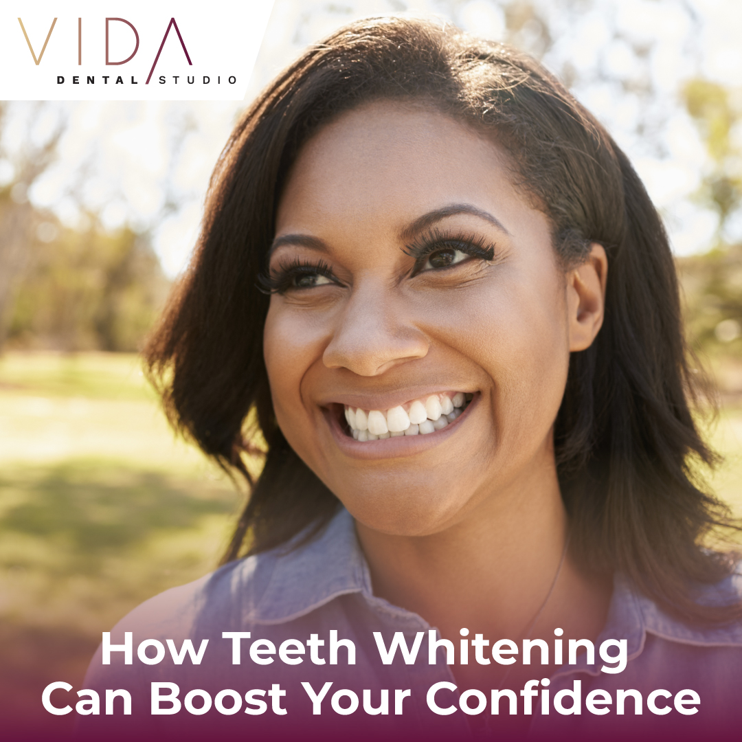 How Teeth Whitening Can Boost Your Confidence in Santa Fe, NM | VIDA ...
